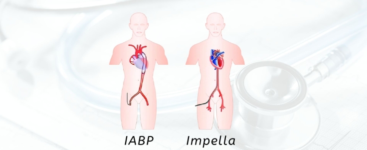 Υψηλού κινδύνου αγγειοπλαστική με χρήση Impella ή IABP - Κωνσταντίνος Ε. Σταθογιάννης ...